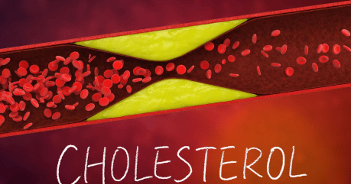 Cholesterol, LDL a HDL – co znamenají a proč je důležité vyšetření ...